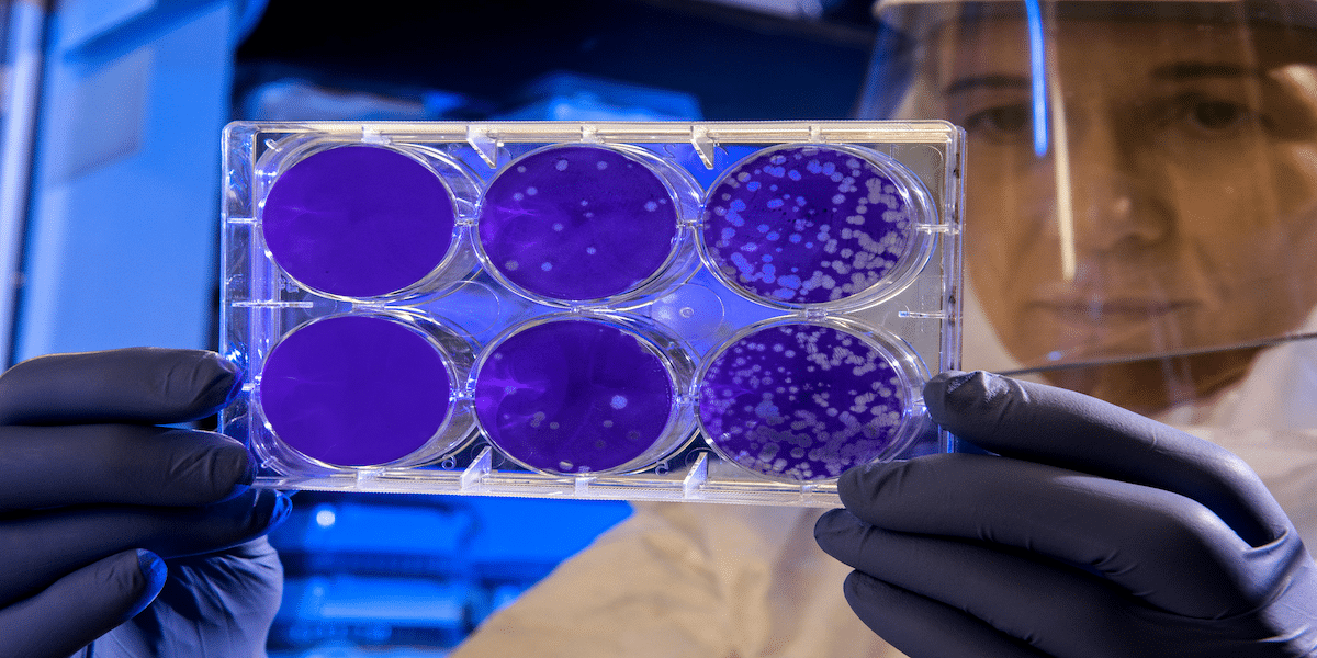 Immunotherapy Regenerative Medicine Center Explains How Stem Cell
