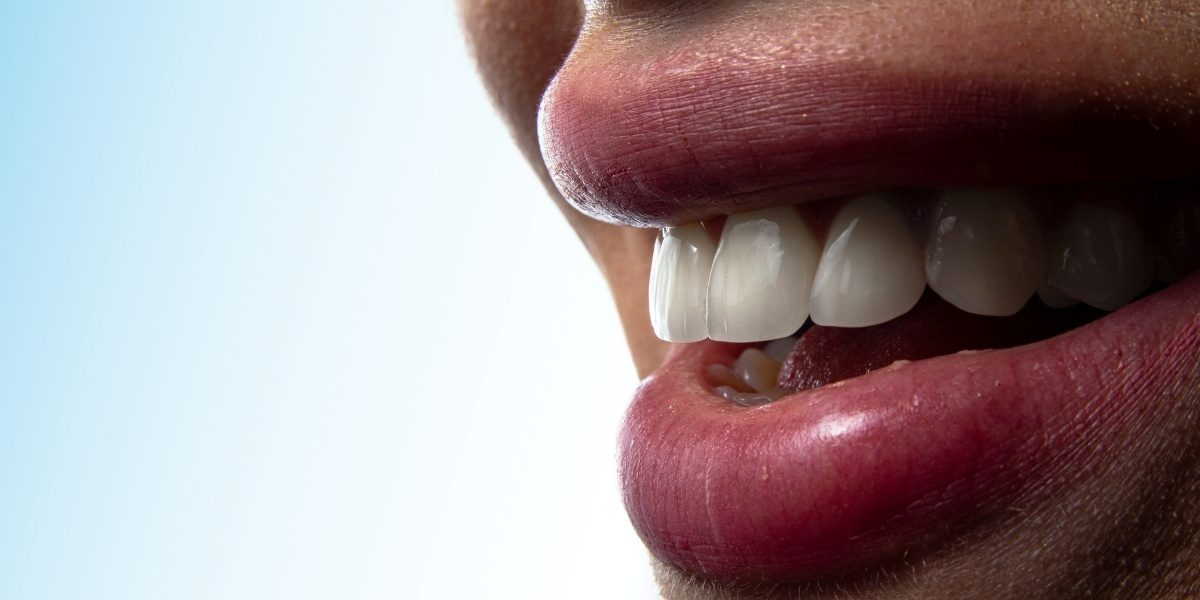 Dental Implants: The Gold Standard for Permanent Tooth Replacement ...